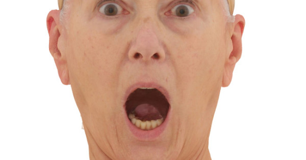 Female 02 Jaw wide Open RAW