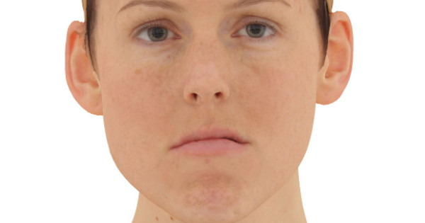 Female 04 Jaw Thrust RAW