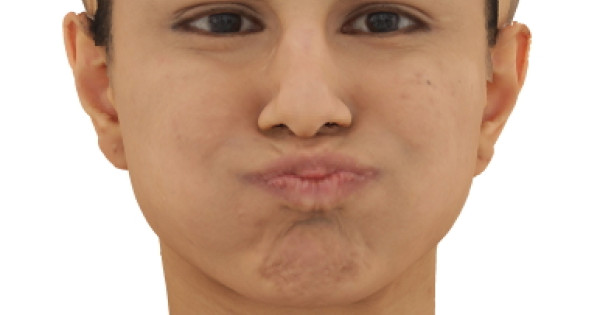 Female 05 Cheek Puff RAW