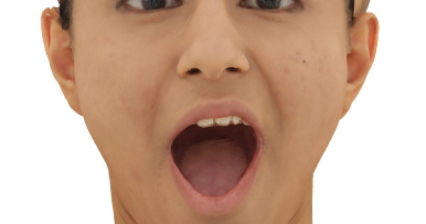 Female 05 Jaw wide Open RAW