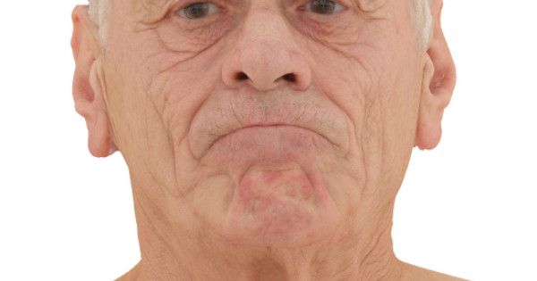 Male 01 Jaw Thrust RAW