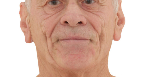 Male 01 Dimple Cheeks RAW