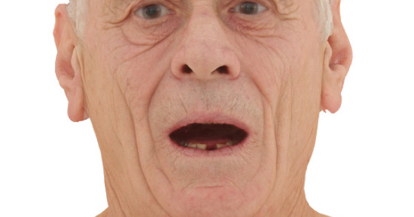 Male 01Neutral Lips Parted RAW