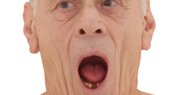 Male 01 Jaw wide Open RAW