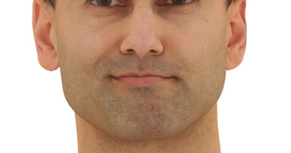 Male 03 Dimple Cheeks RAW