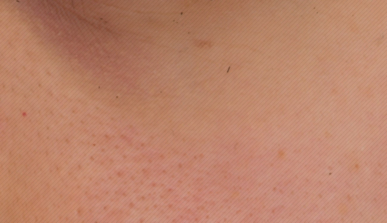 Female 051 / Albedo Map - Female 051 / Albedo Map