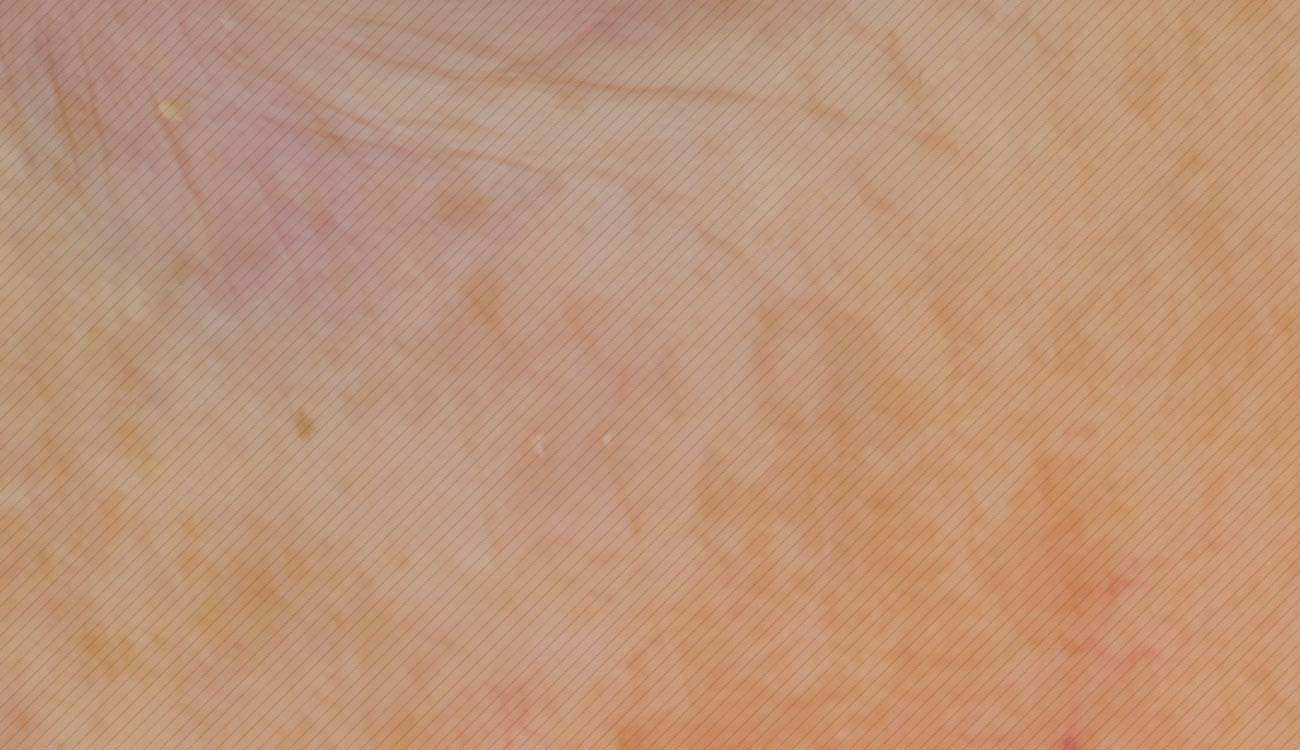 Female 052 / Albedo Map