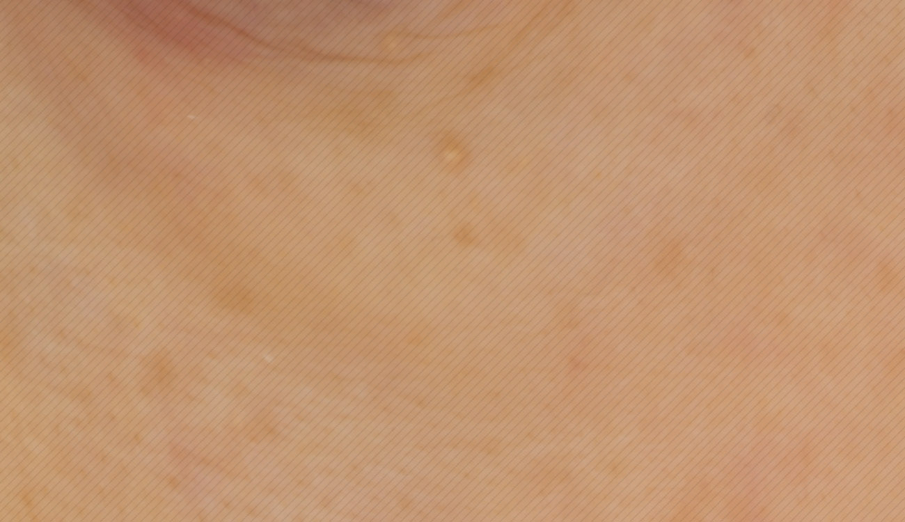 Female 056 / Albedo Map