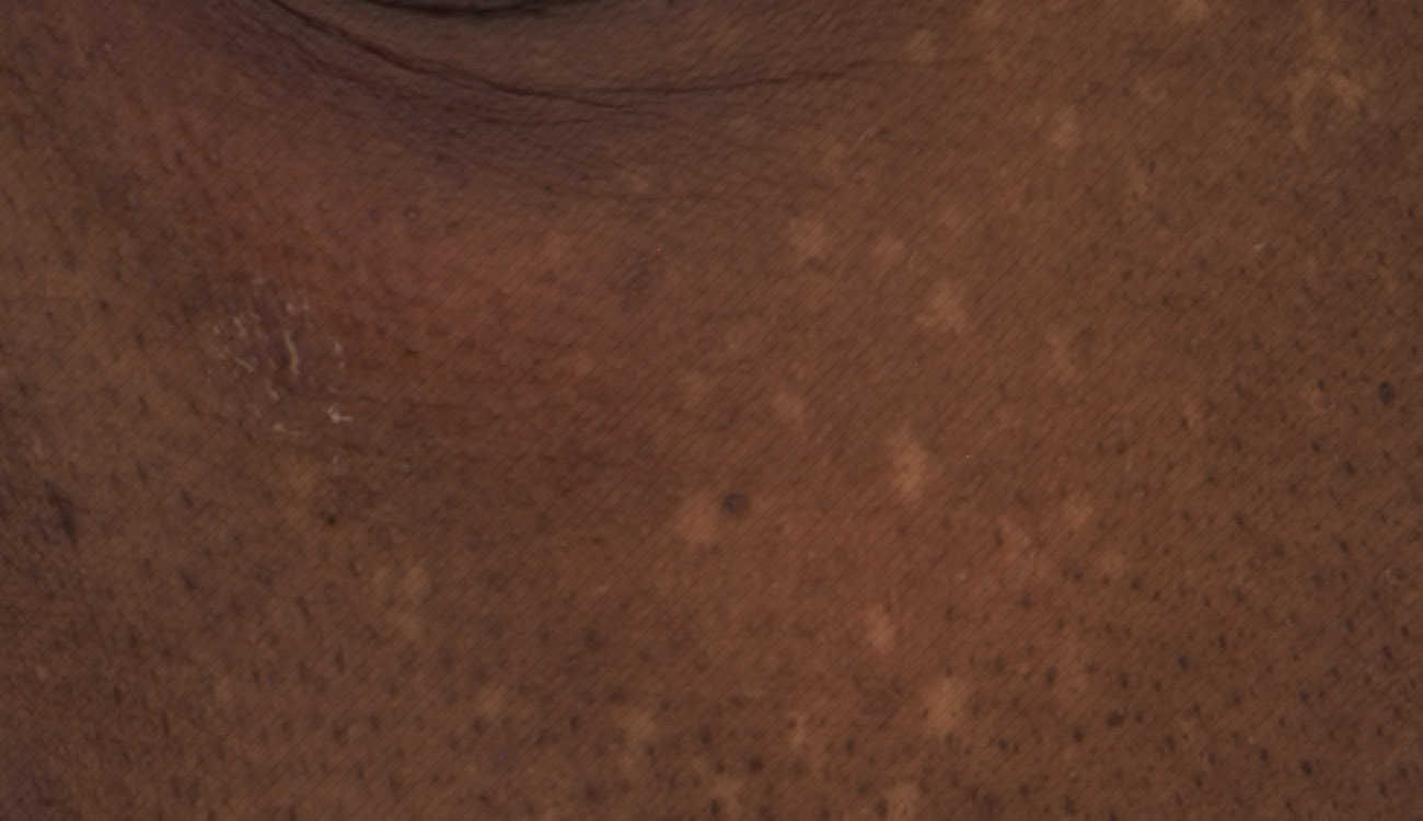 Female 058 / Albedo Map