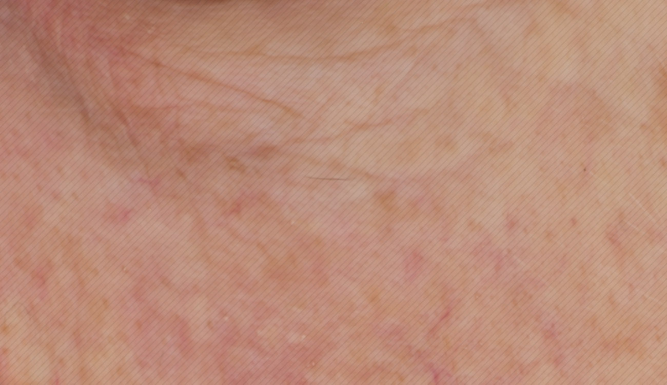 Female 059 / Albedo Map