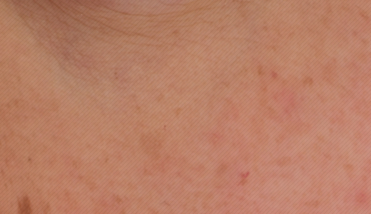 Female 060 / Albedo Map