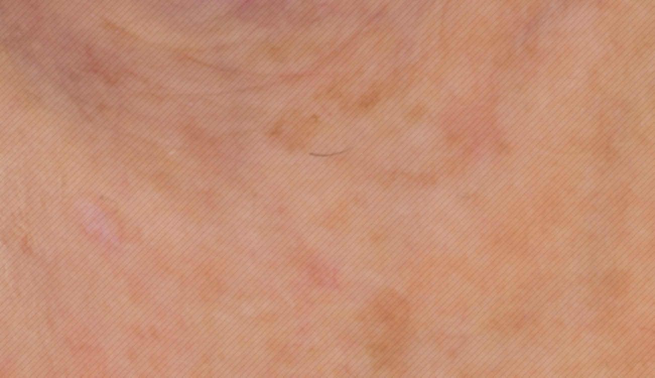 Female 063 / Albedo Map