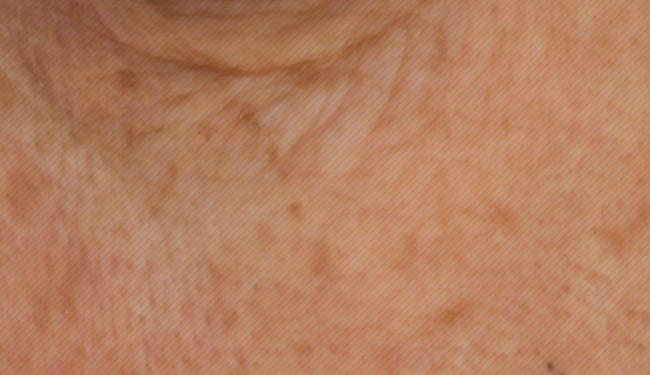 Female 064 / Albedo Map