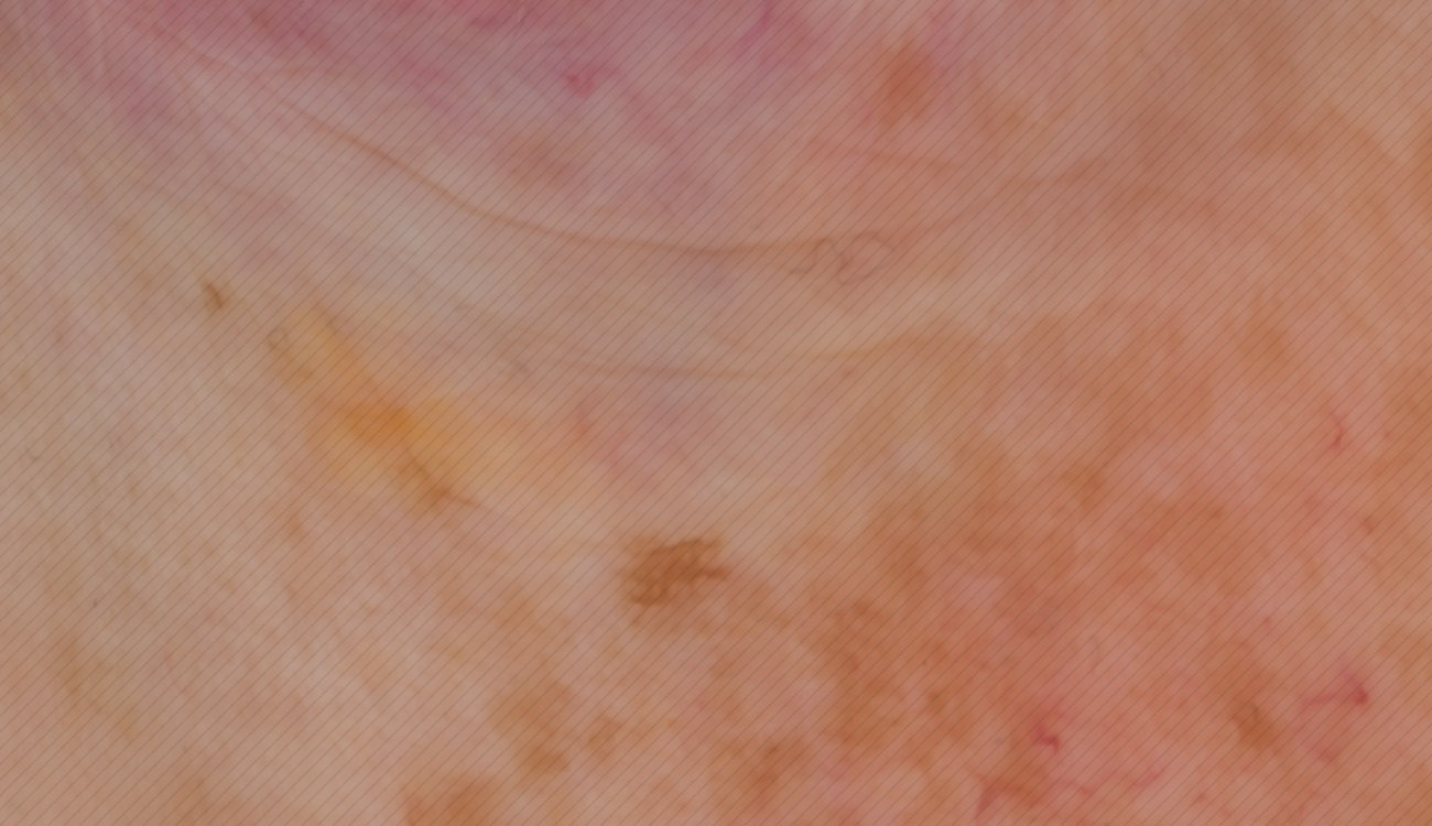 Female 065 / Albedo Map