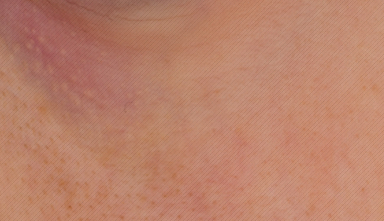 Female 066 / Albedo Map