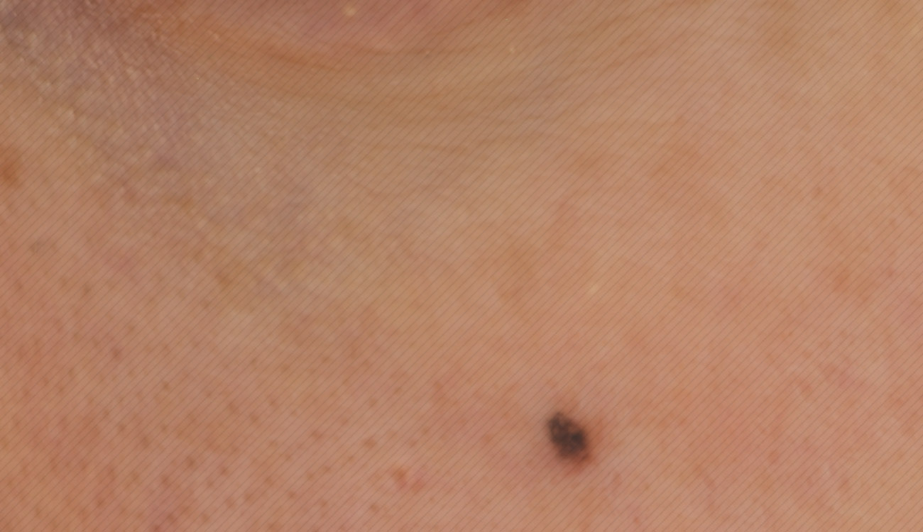 Female 068 / Albedo Map