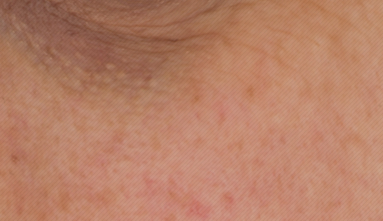 Female 069 / Albedo Map