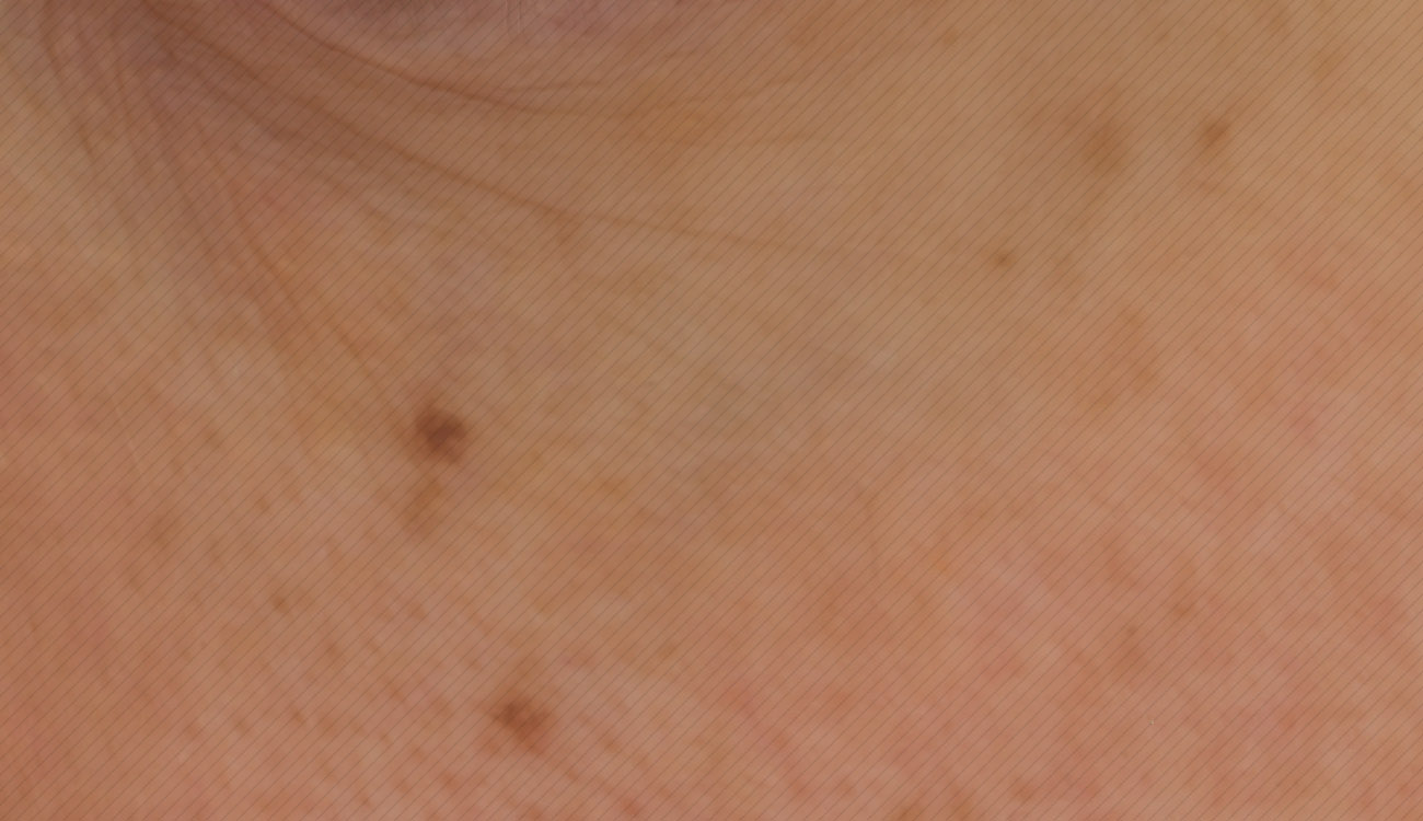 Female 073 / Albedo Map