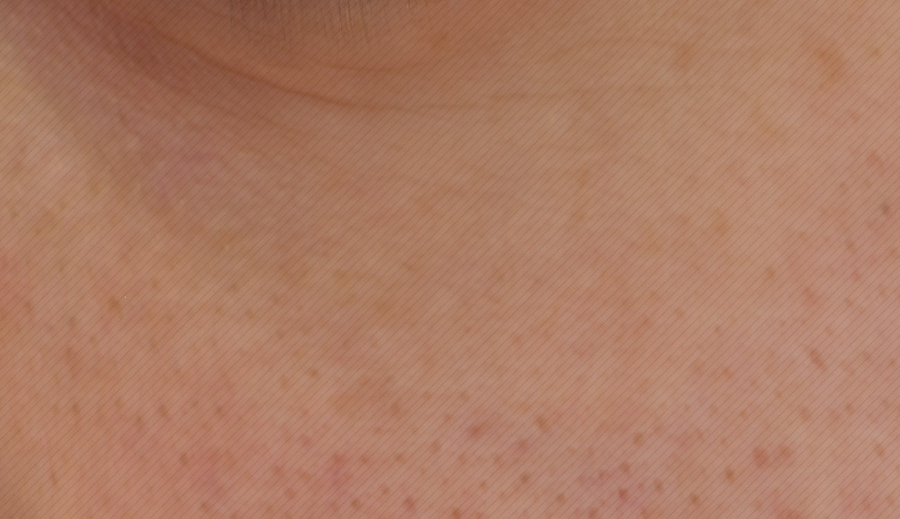 Female 075 / Albedo Map