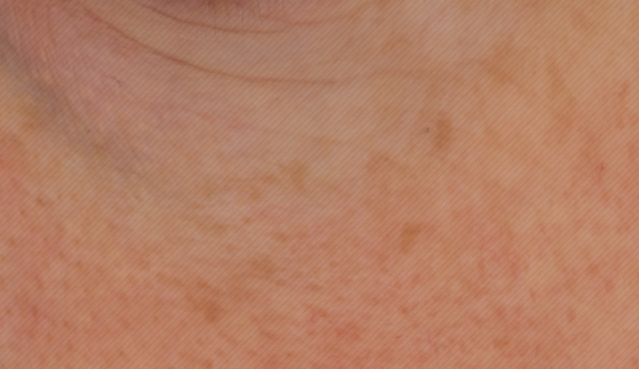 Female 076 / Albedo Map