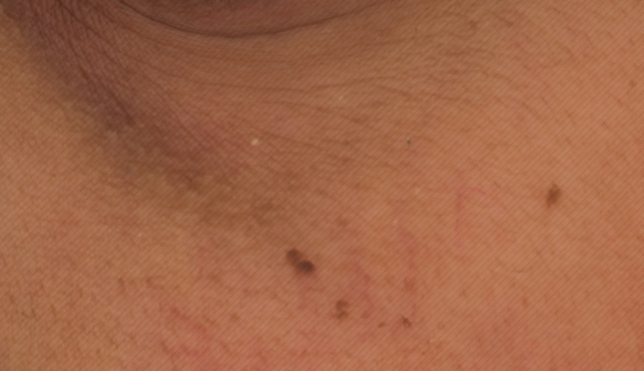 Female 077 / Albedo Map