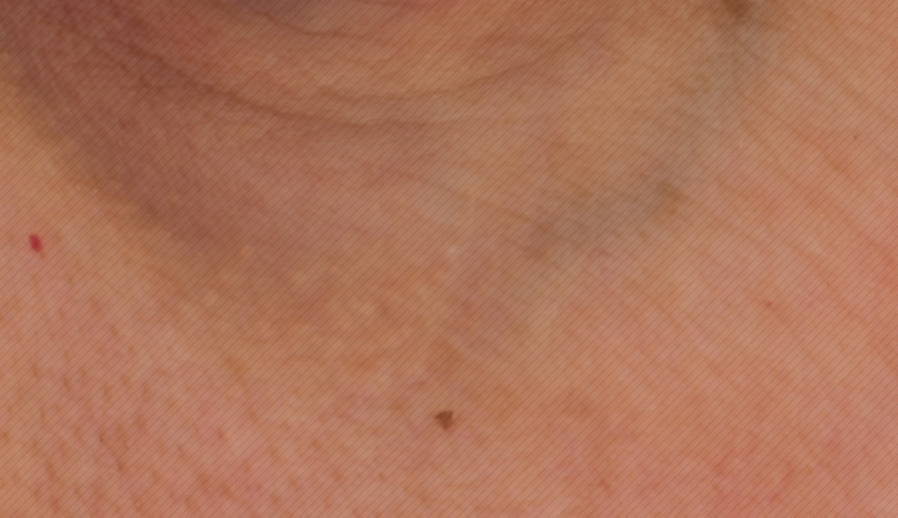 Female 087 / Albedo Map