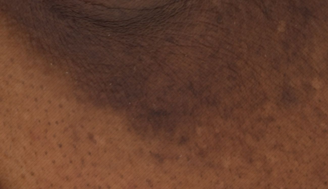 Female 090 / Albedo Map