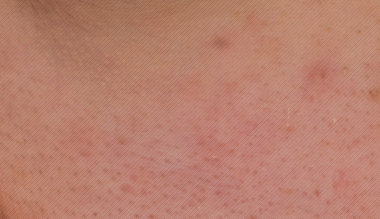 Female 092 / Albedo Map