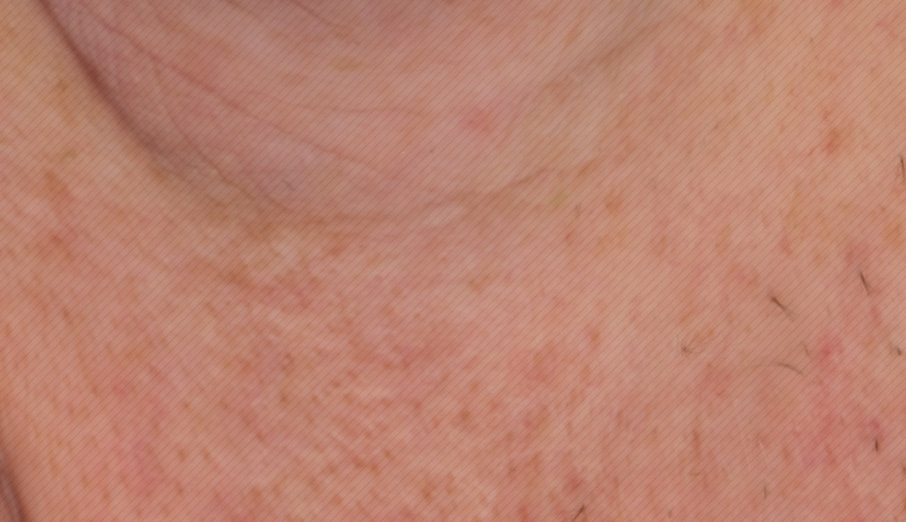 male 054 / Albedo Map