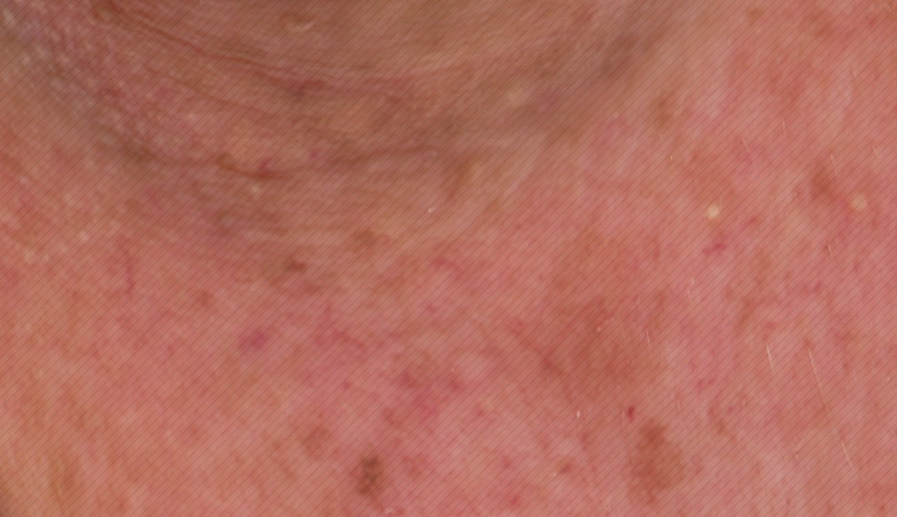 male 058 / Albedo Map