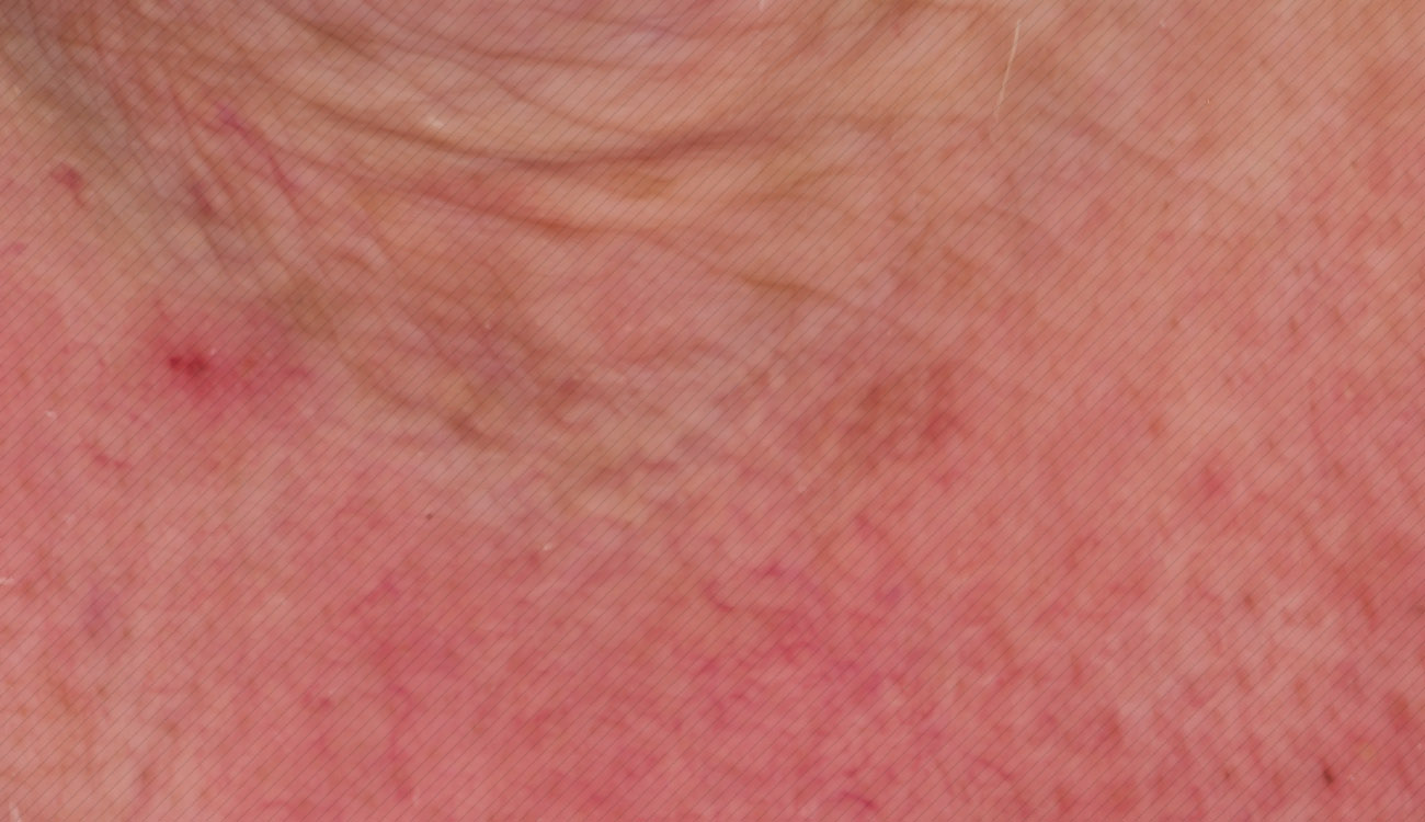 male 059 / Albedo Map