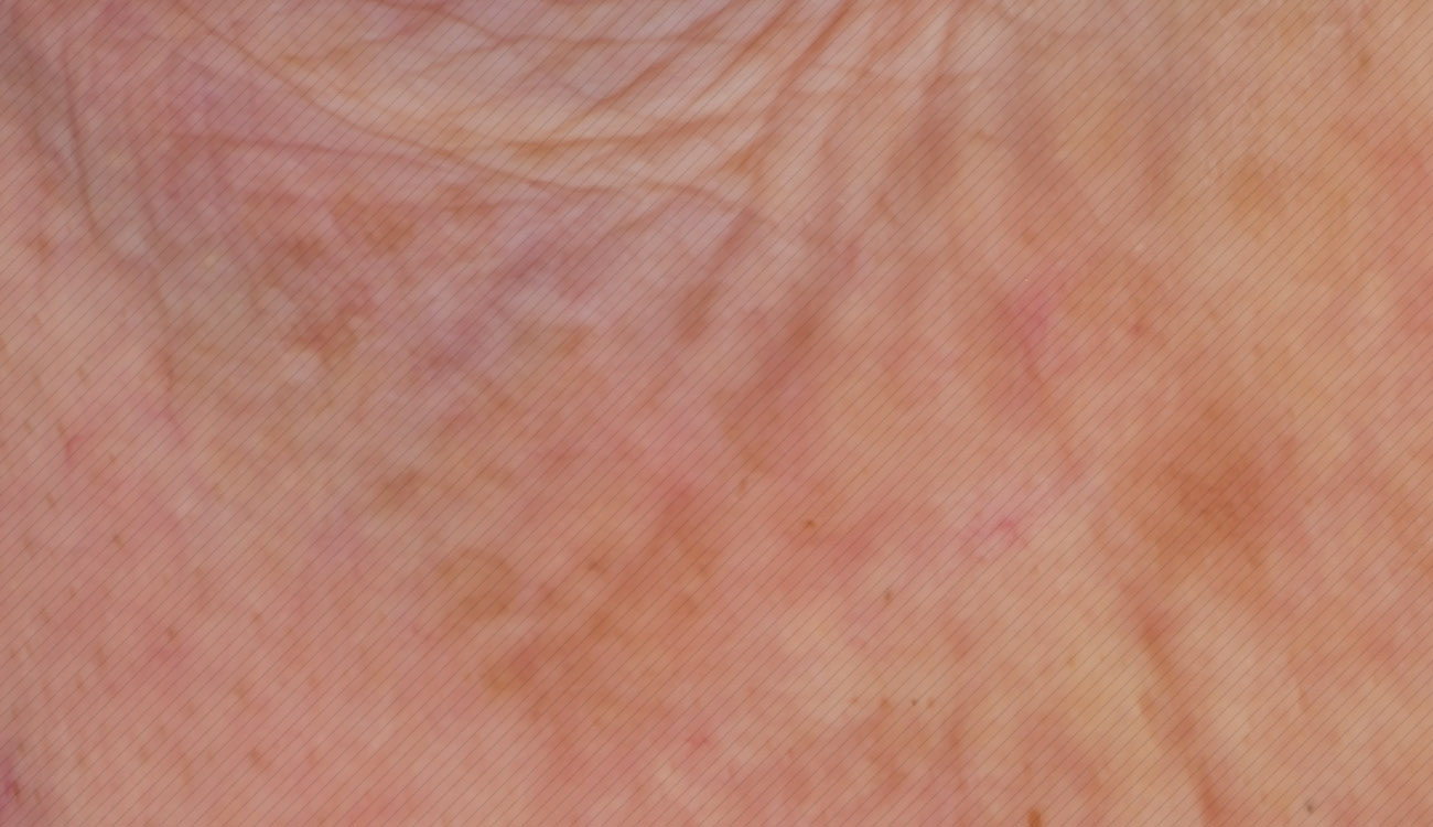 male 060 / Albedo Map