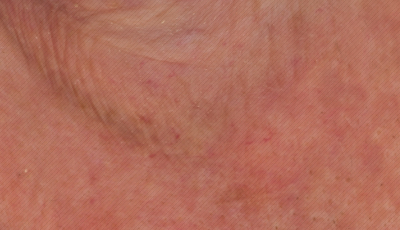 male 070 / Albedo Map