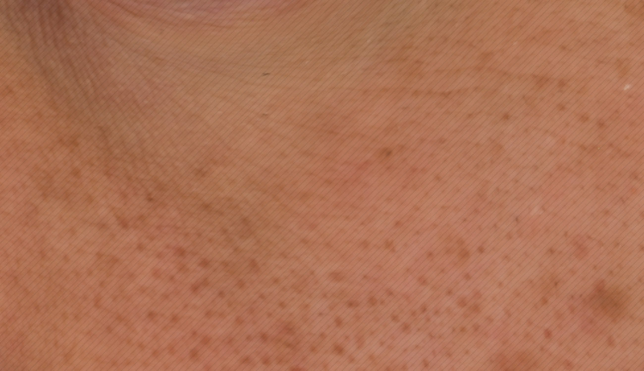 male 073 / Albedo Map