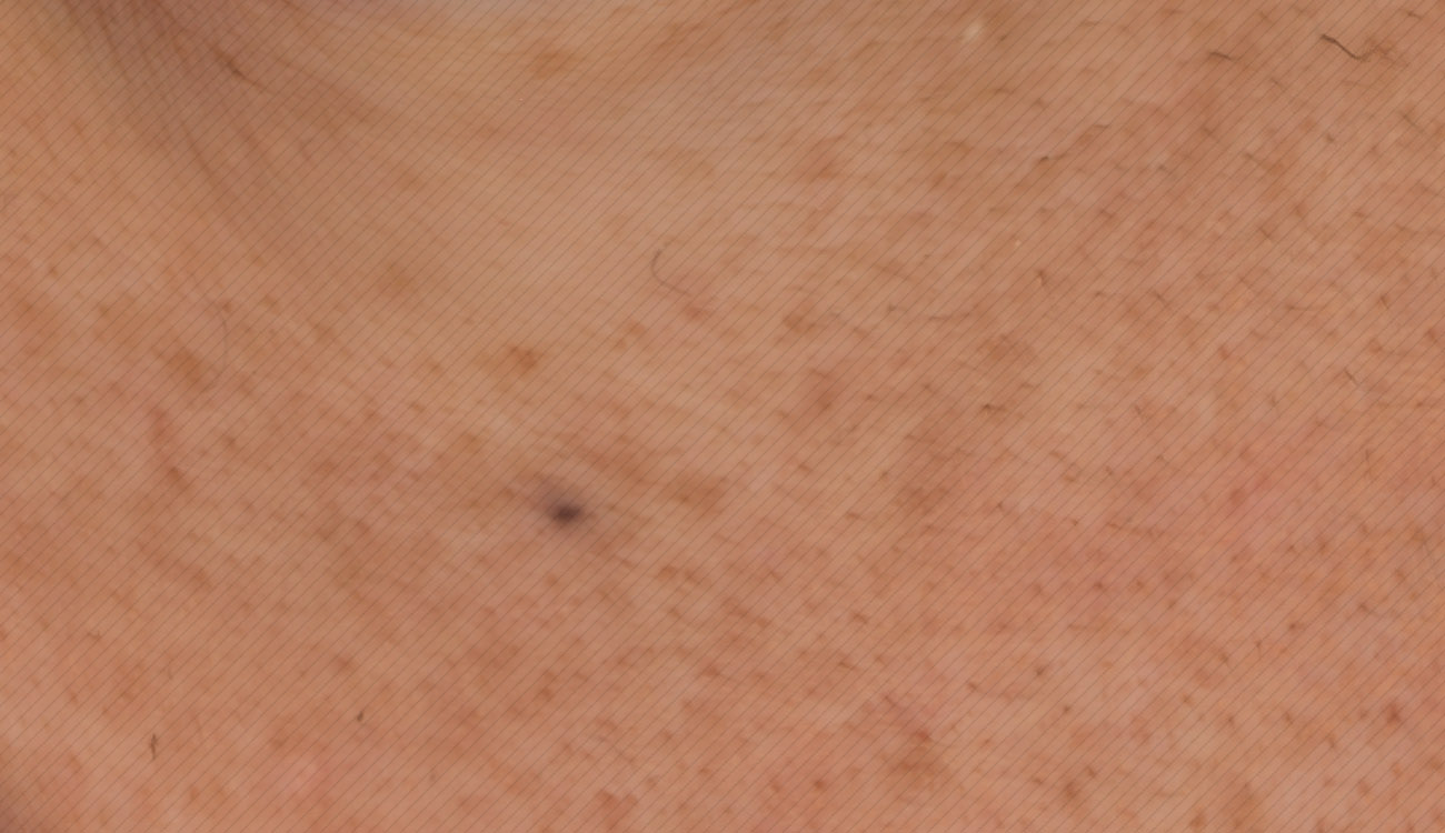 male 080 / Albedo Map