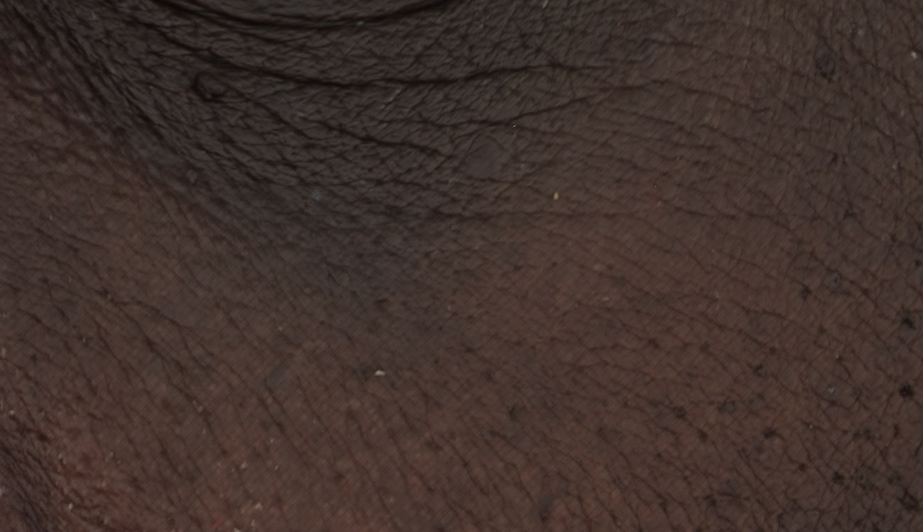 male 082 / Albedo Map