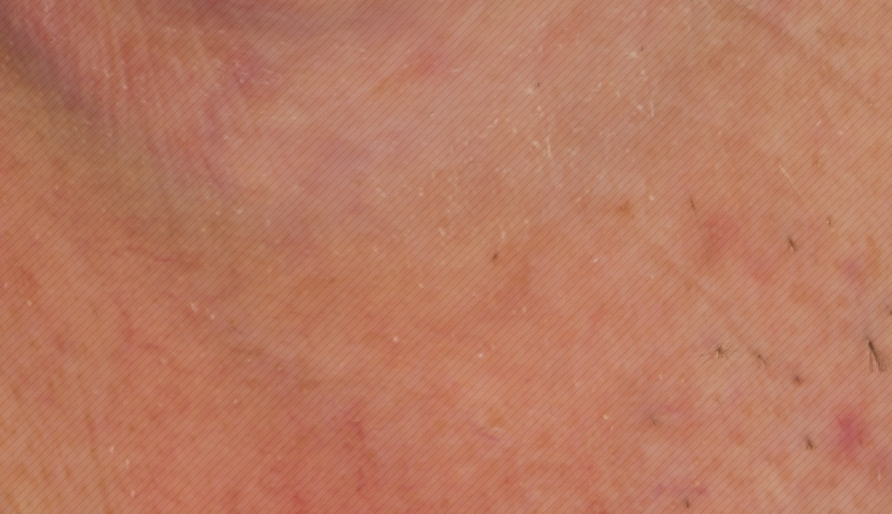 male 083 / Albedo Map