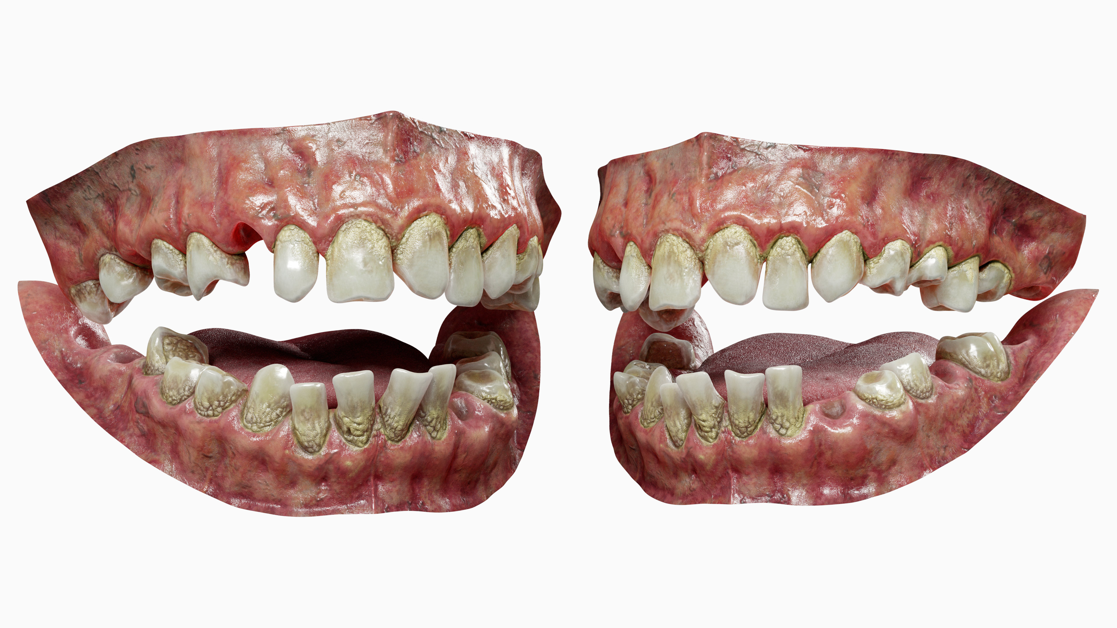 Realistic 3D Teeth with - Includes Blender, Marmoset, and ZTL Files