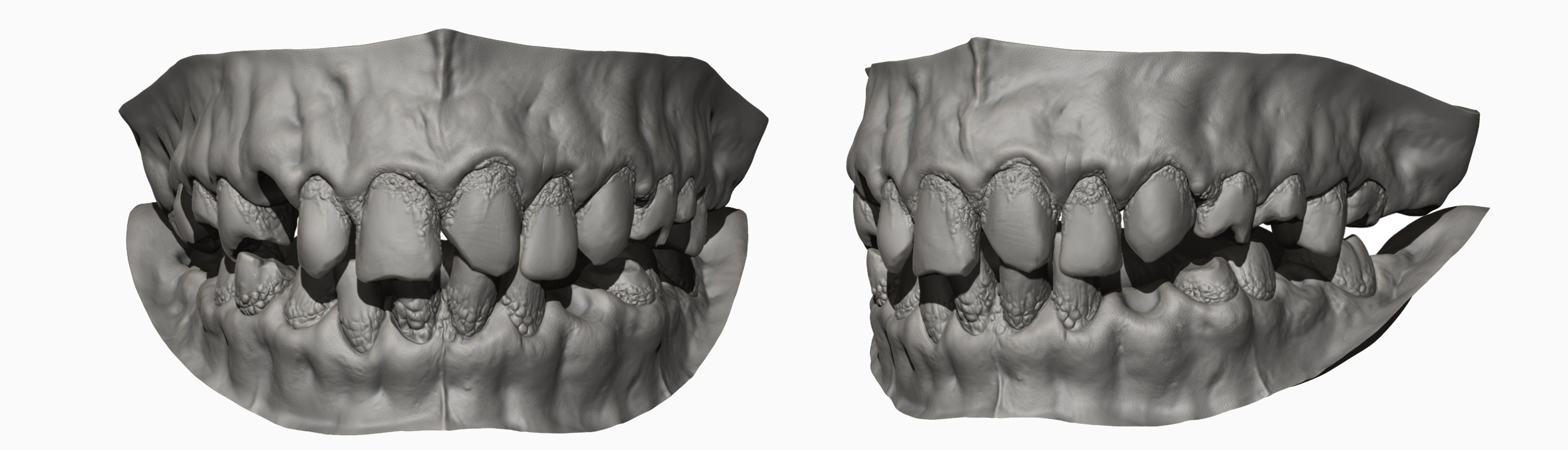 Realistic 3D Gnarly Rotten Teeth Model - Includes Blender, Marmoset ...
