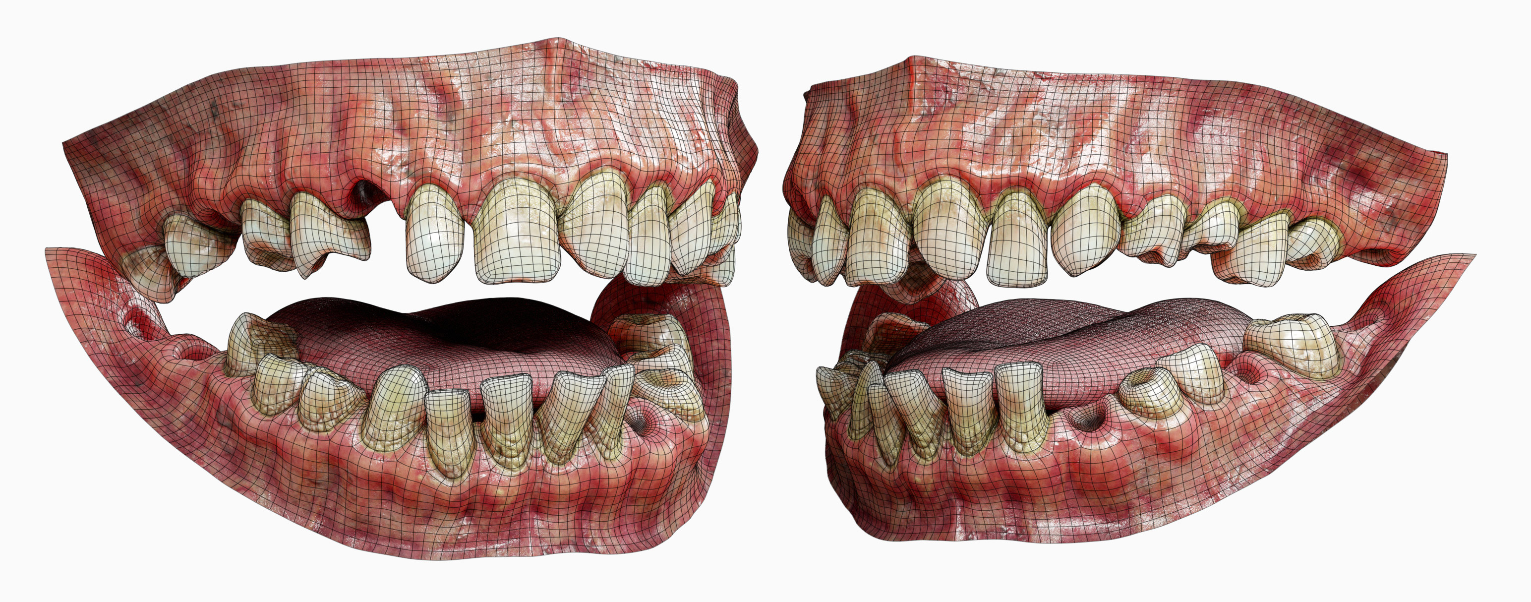 Realistic 3D Gnarly Rotten Teeth Model - Includes Blender, Marmoset ...