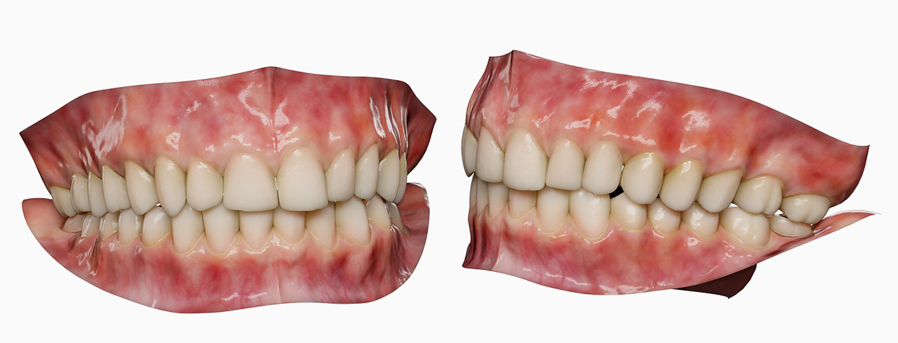 Realistic 3D Clean Straight Teeth Model - Includes Blender, Marmoset ...