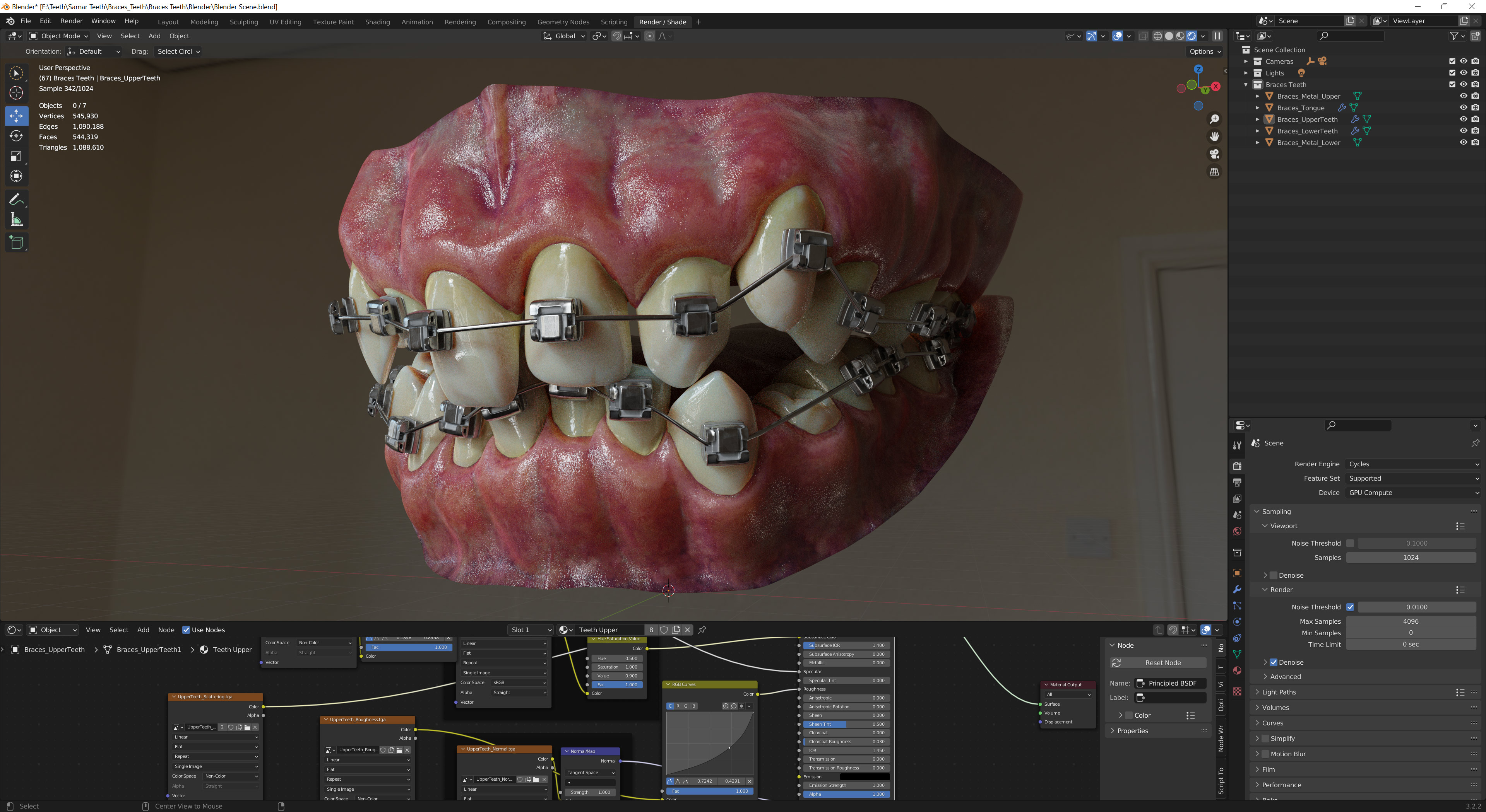 Realistic 3D Teeth with Braces Model - Includes Blender, Marmoset, and ...