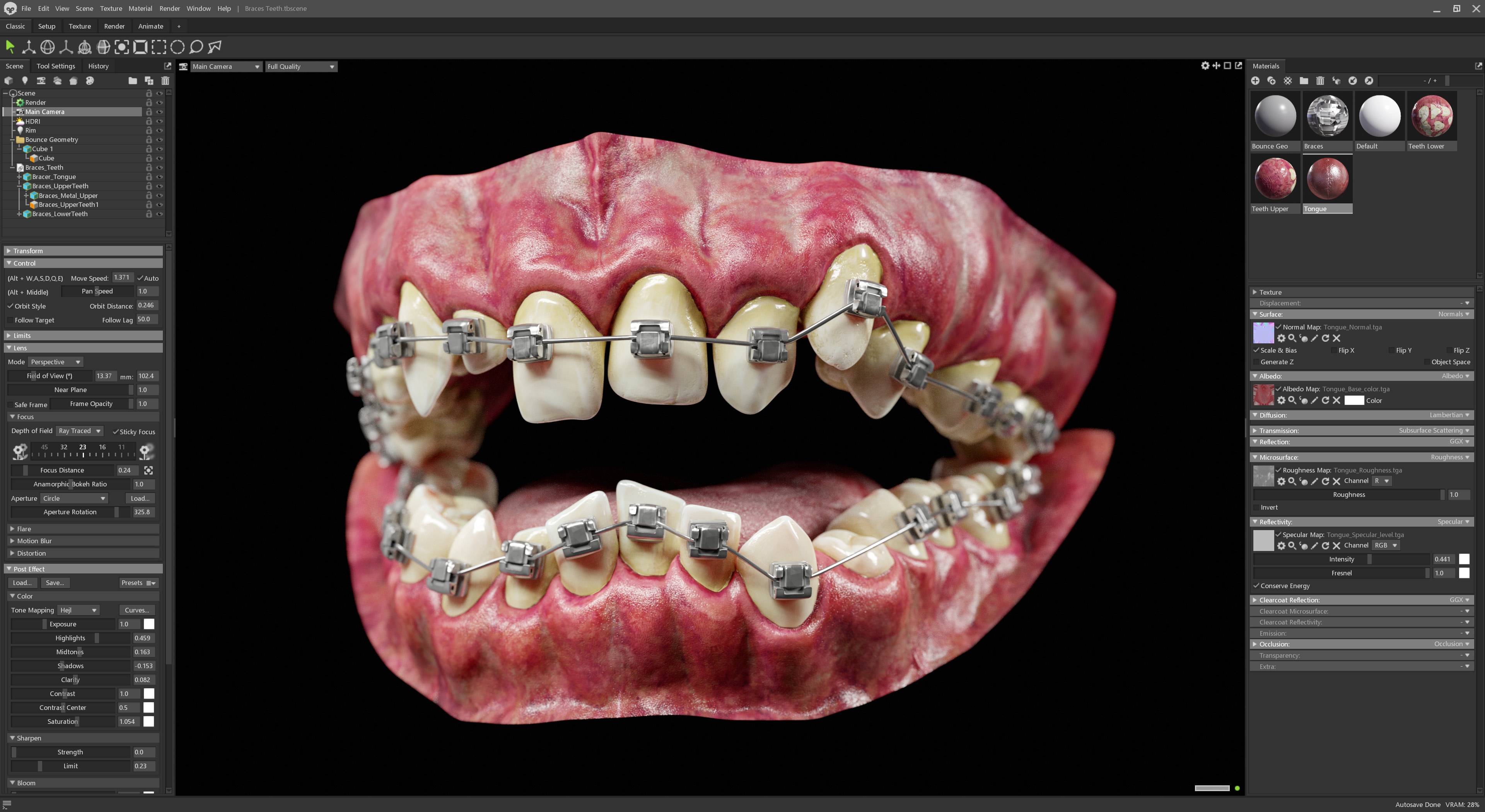 Realistic 3D Teeth with Braces Model - Includes Blender, Marmoset, and ...