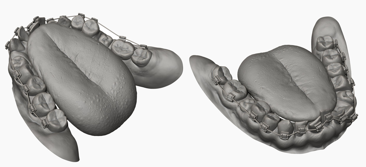 Realistic 3D Teeth with - Includes Blender, Marmoset, and ZTL Files