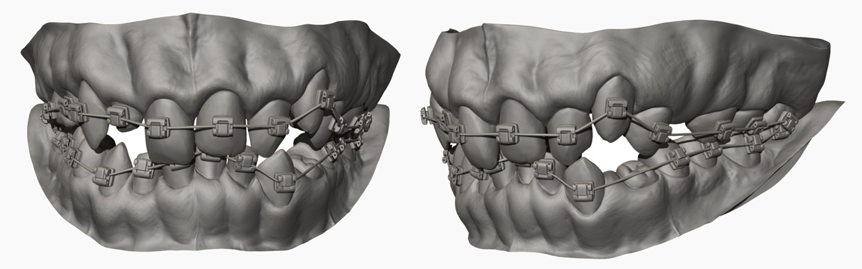 Realistic 3D Teeth with - Includes Blender, Marmoset, and ZTL Files