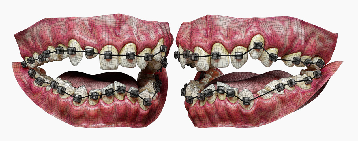 Realistic 3D Teeth with - Includes Blender, Marmoset, and ZTL Files